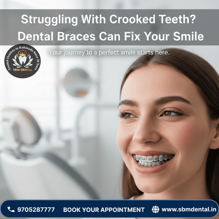 Struggling With Crooked Teeth? Dental Braces in Kakinada